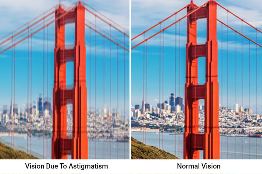 Diff rents Troubles Visuels